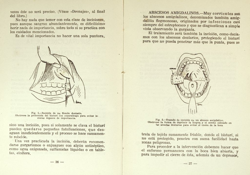:: Supuraciones (noviembre 1946) :: Fisiología y enfermedades ...